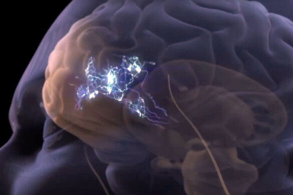 guaifenesin mechanism of action Archives - Guaifenesin.org